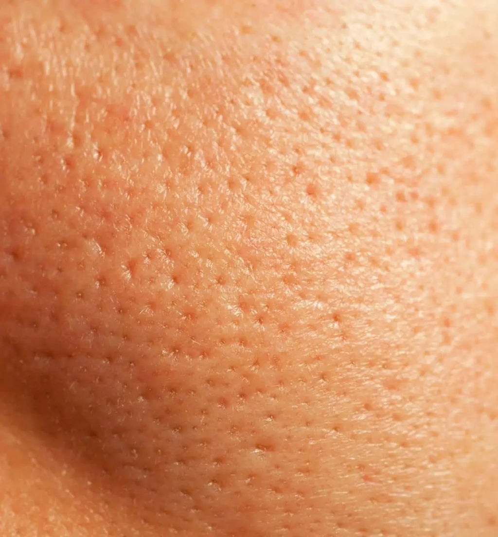 texture skin