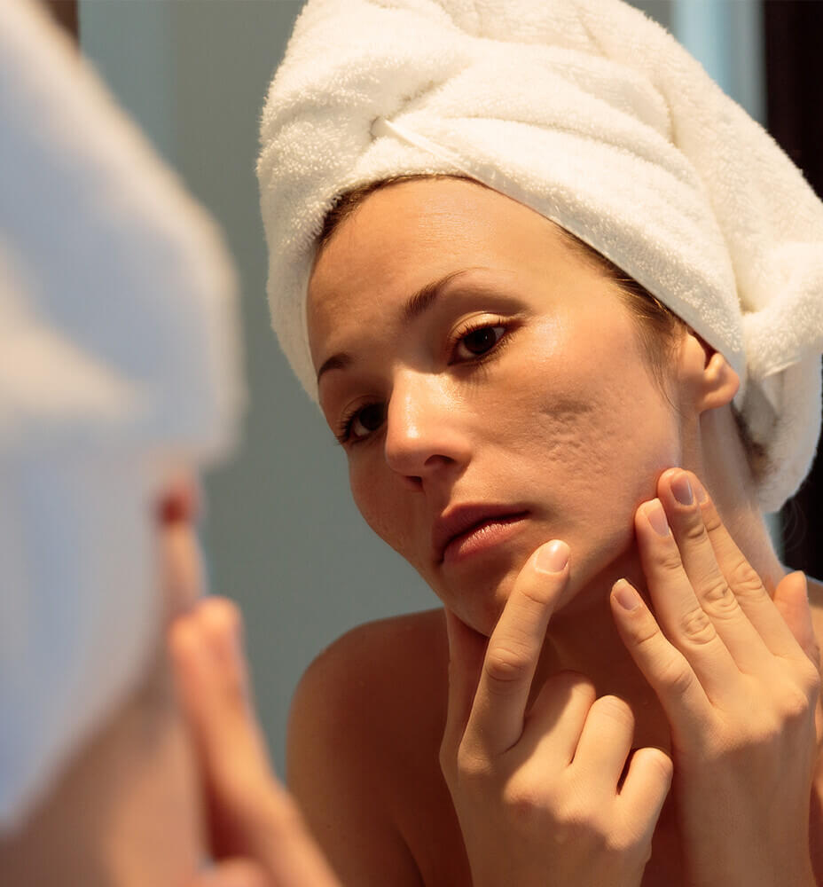 5 Best Essential Oils For Scars – 100% PURE